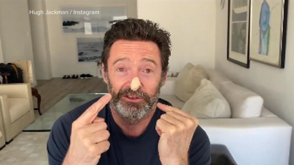 Video Hugh Jackman Reveals Results Of Skin Cancer Biopsies Abc News