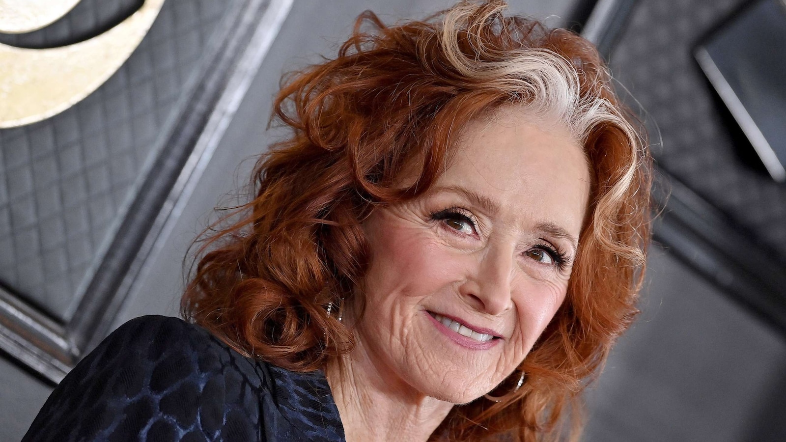 Bonnie Raitt shares health update after surgery for 'medical situation ...