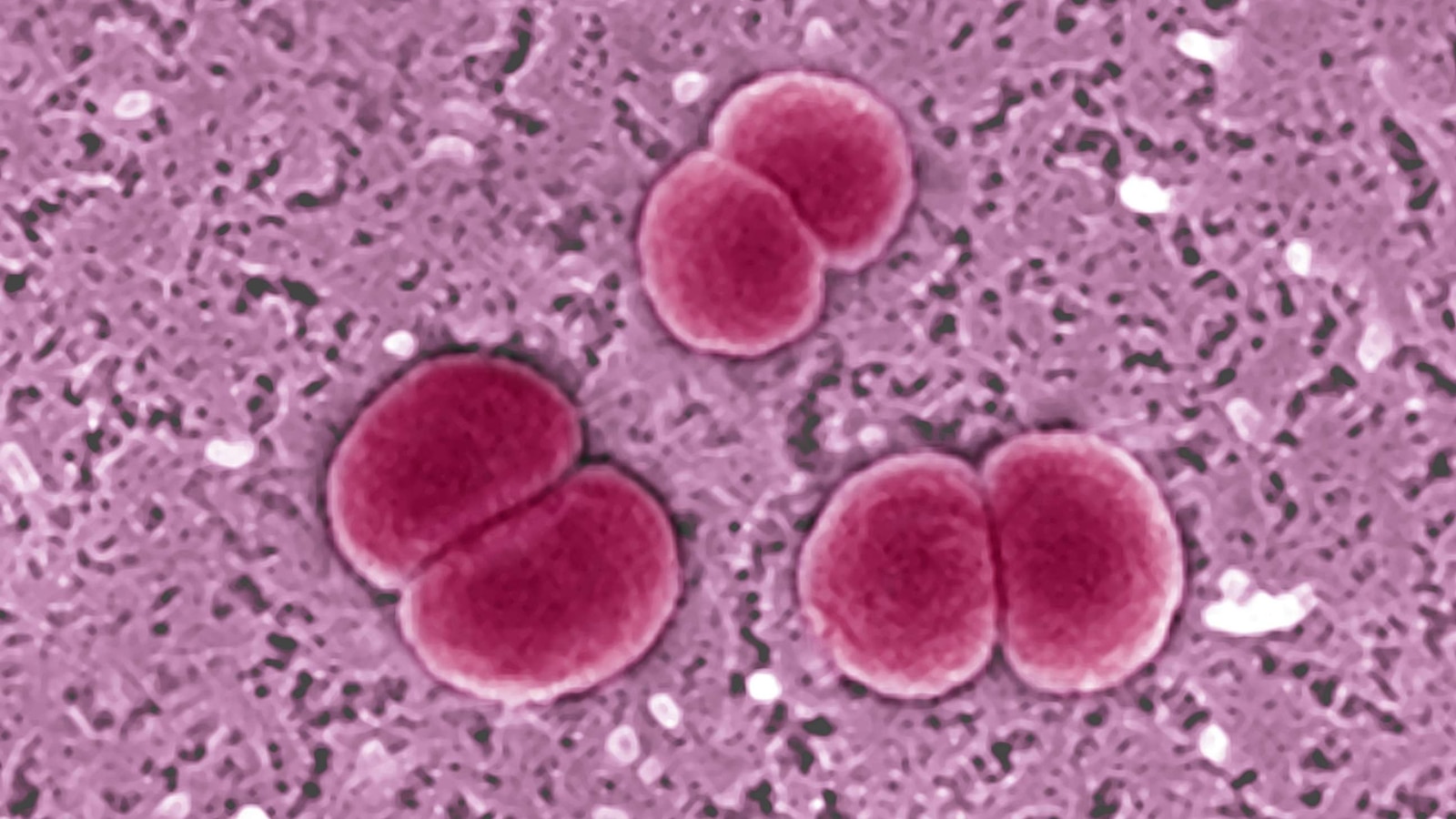 Neisseria Meningitidis The Deadly Bacteria A Collision Target Mediated