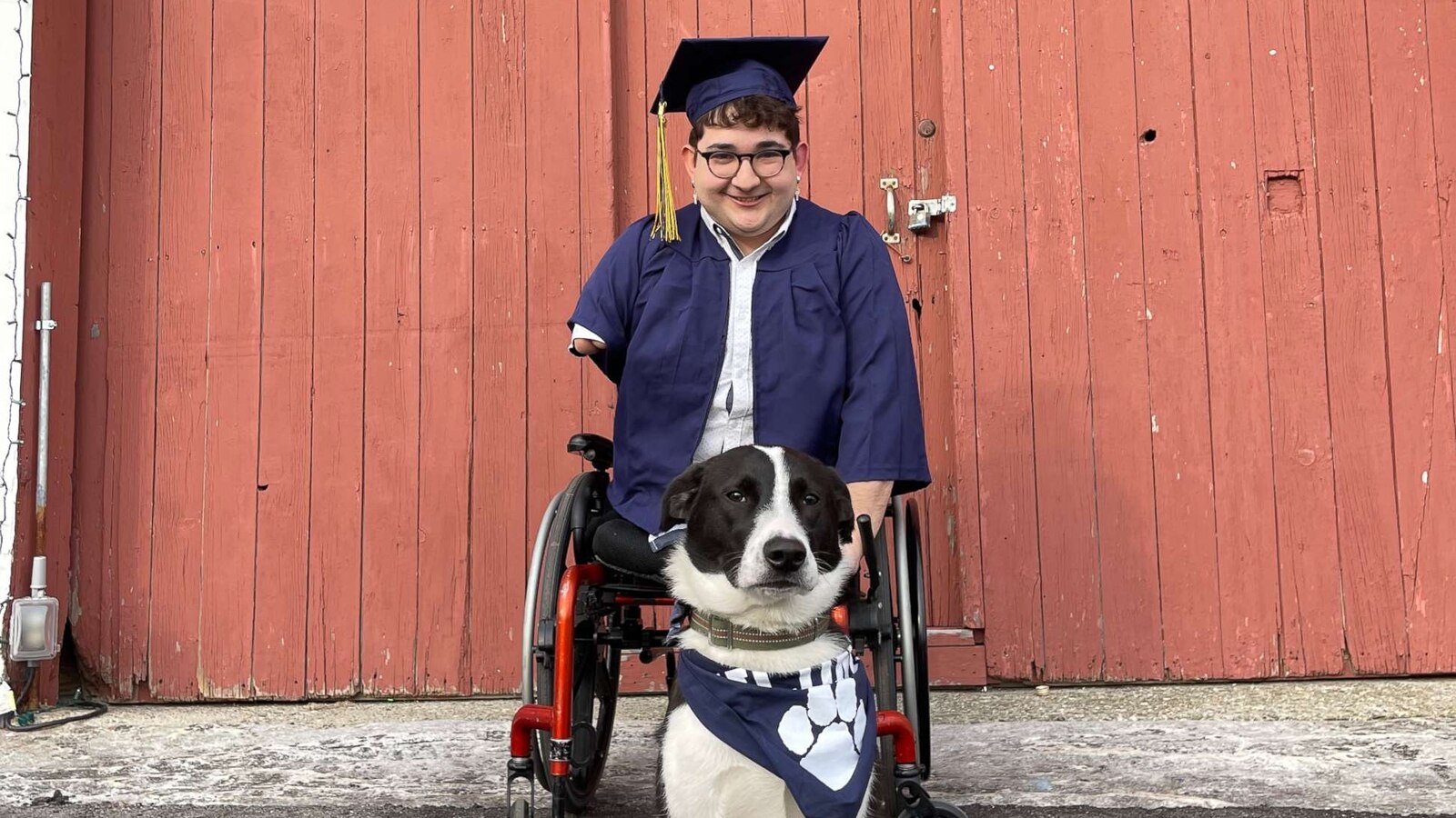 Man shares his life on TikTok to celebrate limb differences - ABC News