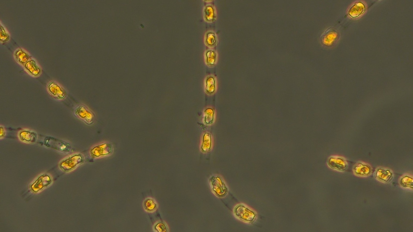 Brown Algae Under Microscope Labeled 2,100+ Algae Microscope Stock