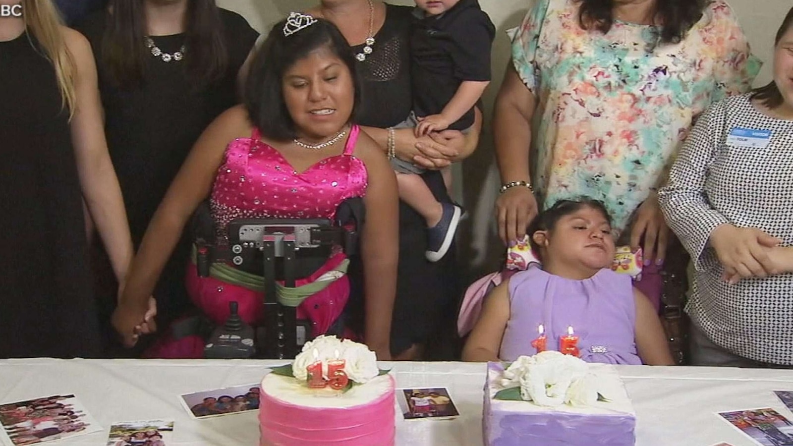 Formerly conjoined twins celebrate 21st birthday and 20th anniversary ...