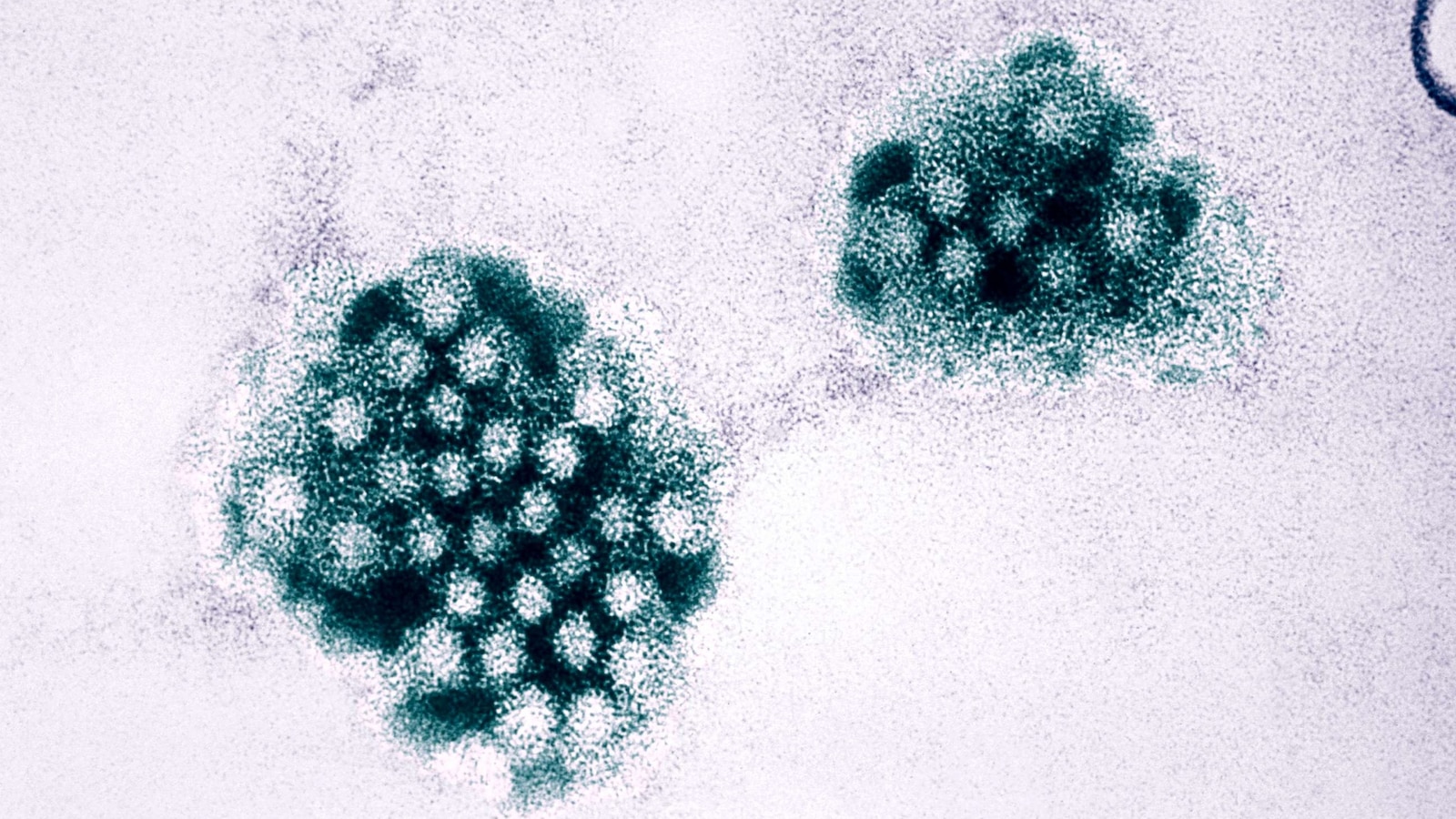 What to know about the symptoms and treatment of norovirus as it spreads across the US - ABC News