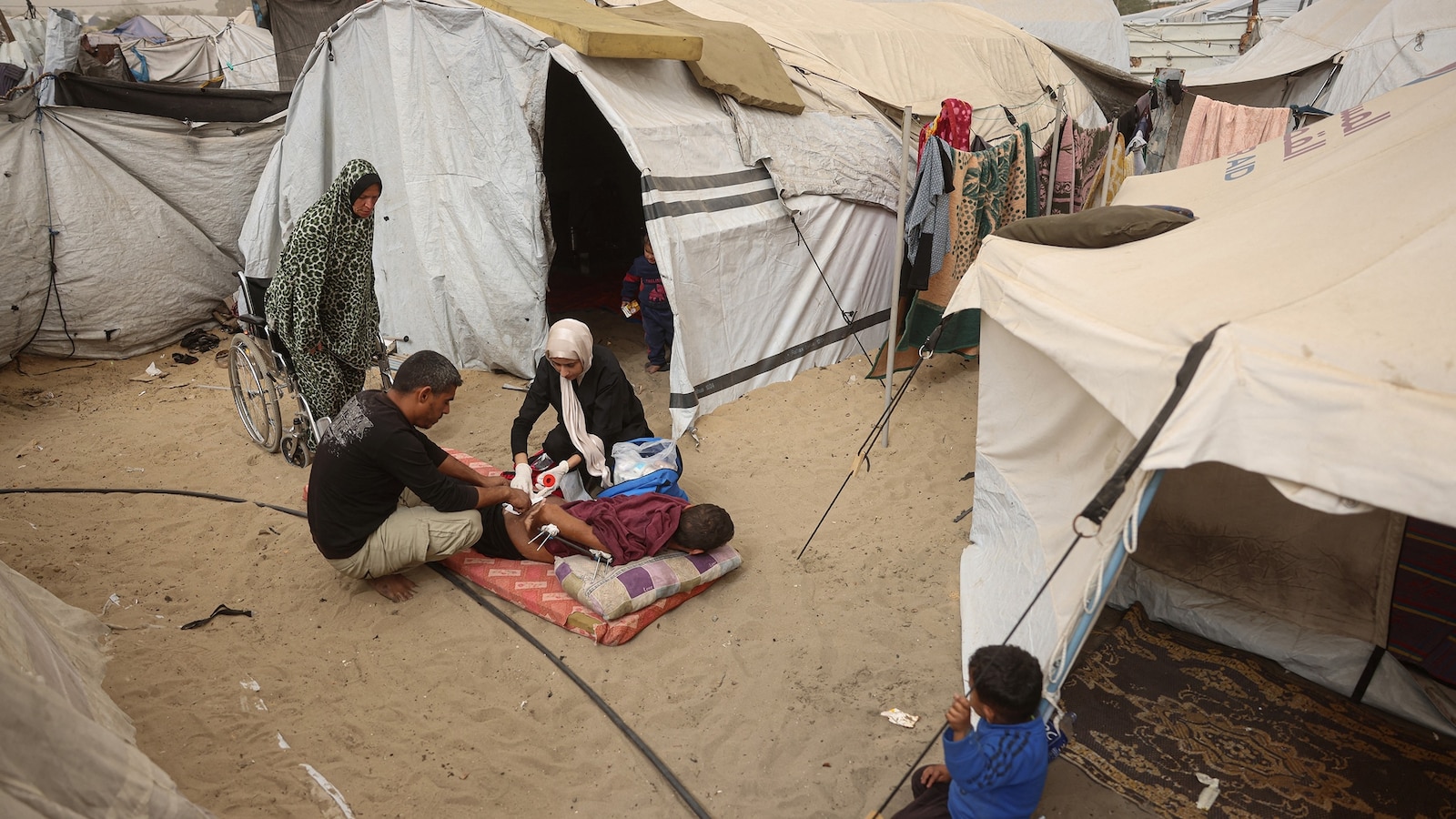 Up to 46,000 injuries in Gaza require reconstructive surgery: Study ...
