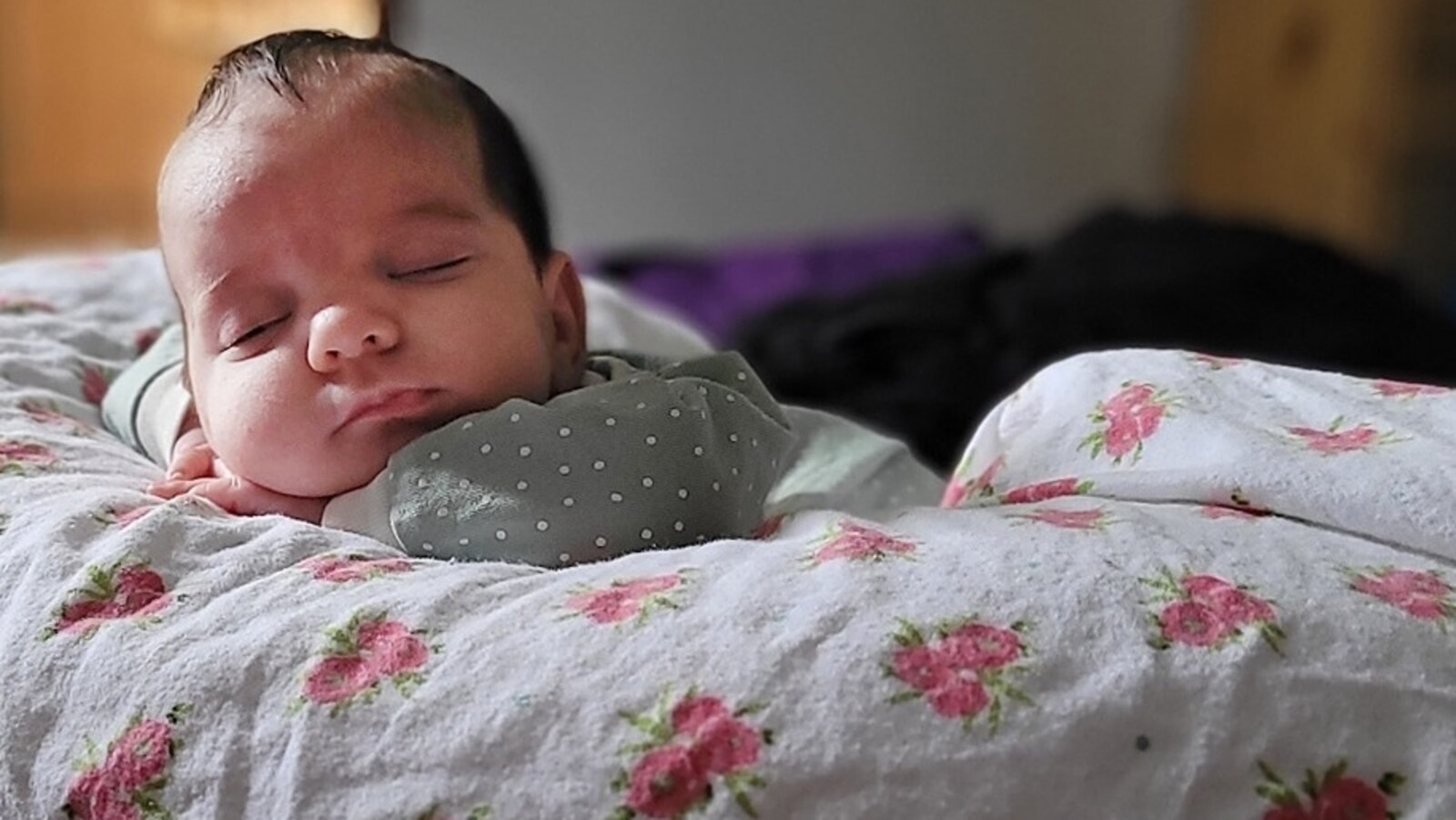 Baby born with rare 4-pound tumor on her spine - ABC News