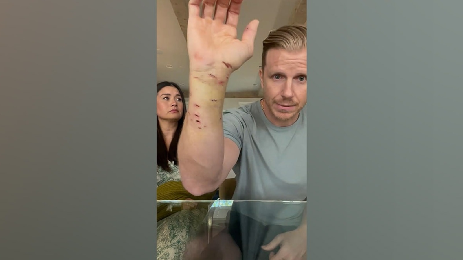 'Bachelor' alum Sean Lowe details injuries after attack by rescue dog ...