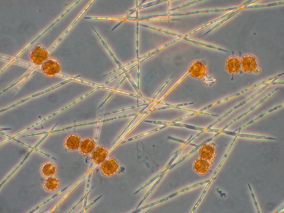 Toxic algae blooms increasing in Arctic due to climate change, new ...