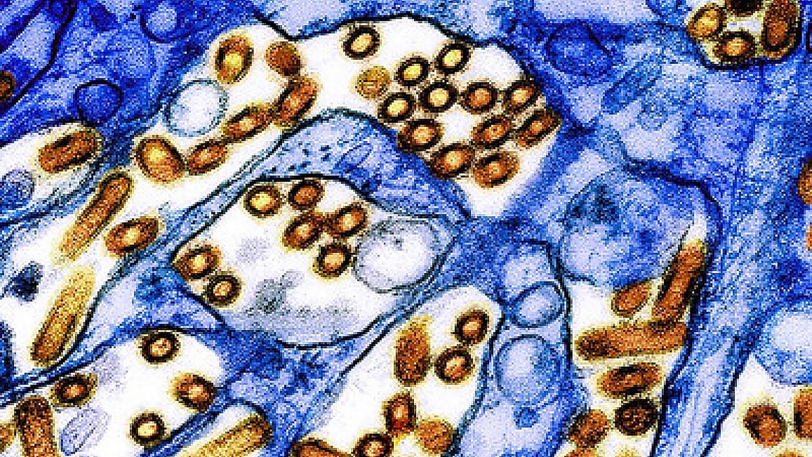 New Initiative Launched By Who To Develop Mrna Bird Flu Vaccines Abc News