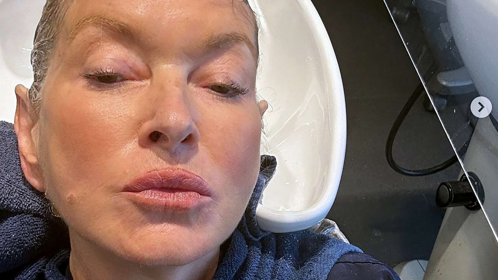 Martha Stewart shows off up-close selfie of her skin after having a ...