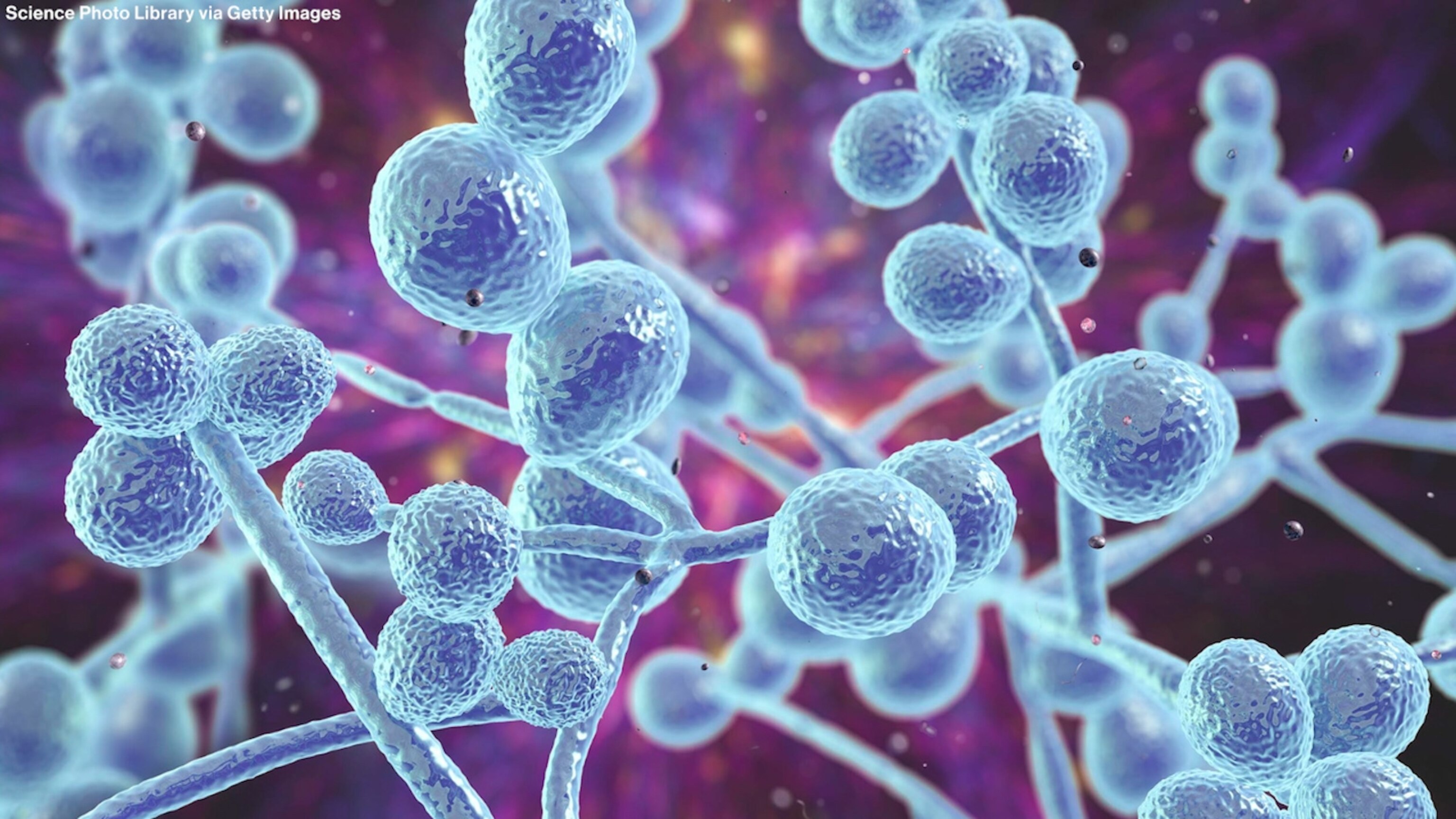 Fungal Meningitis Symptoms