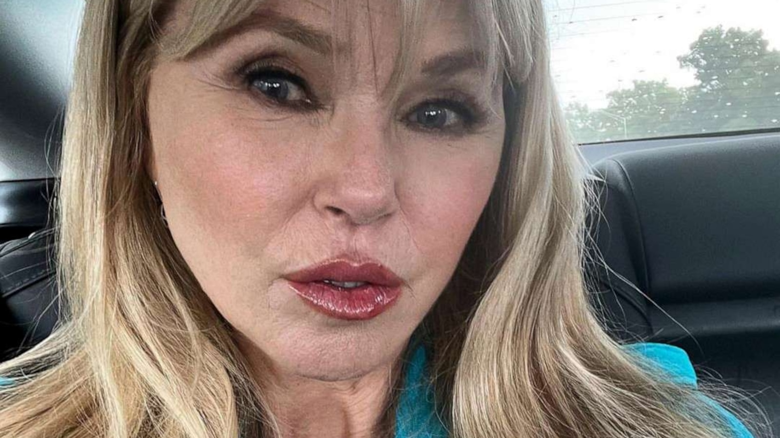 Christie Brinkley responds to 'wrinkle brigade' critics - ABC News